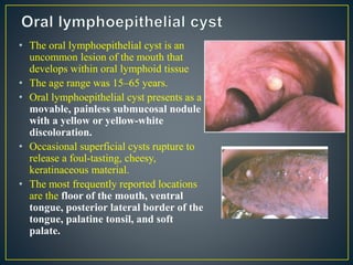 Non odontogenic cyst and pseudo cyst of the jaw- seminar 2- ORIGINAL.pptx
