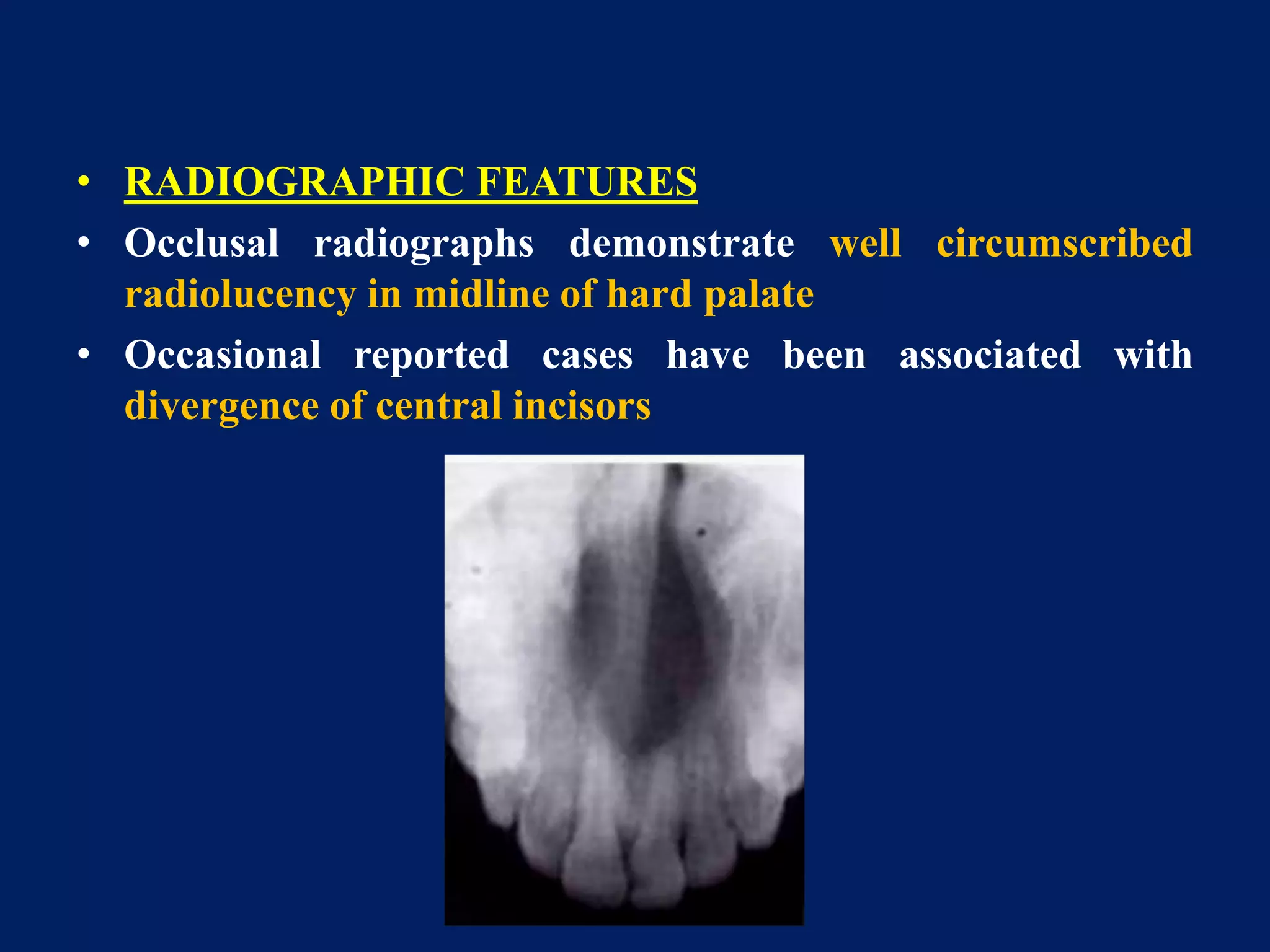 Non odontogenic cysts or fissural cysts | PPTX