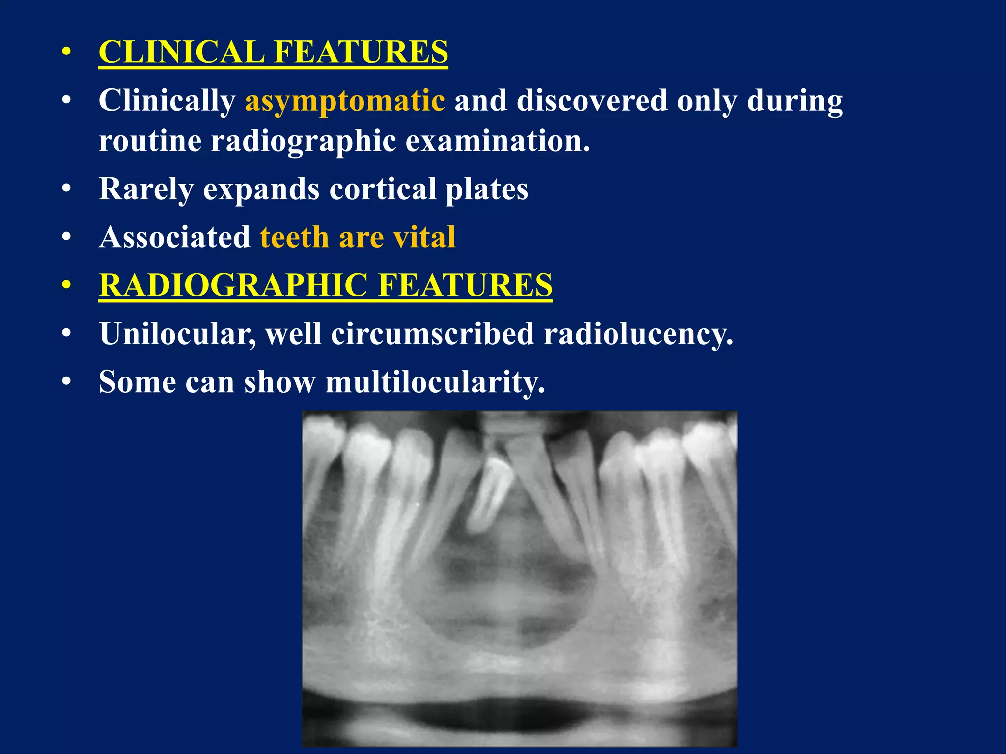 Non odontogenic cysts or fissural cysts | PPTX