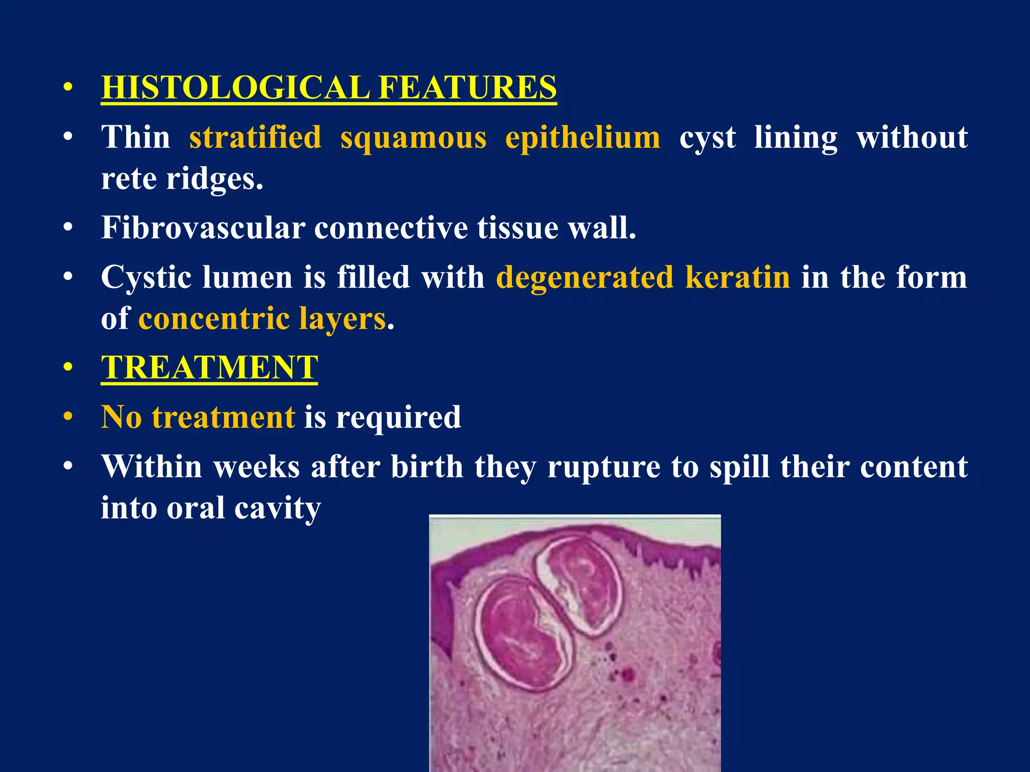 Non odontogenic cysts or fissural cysts | PPTX