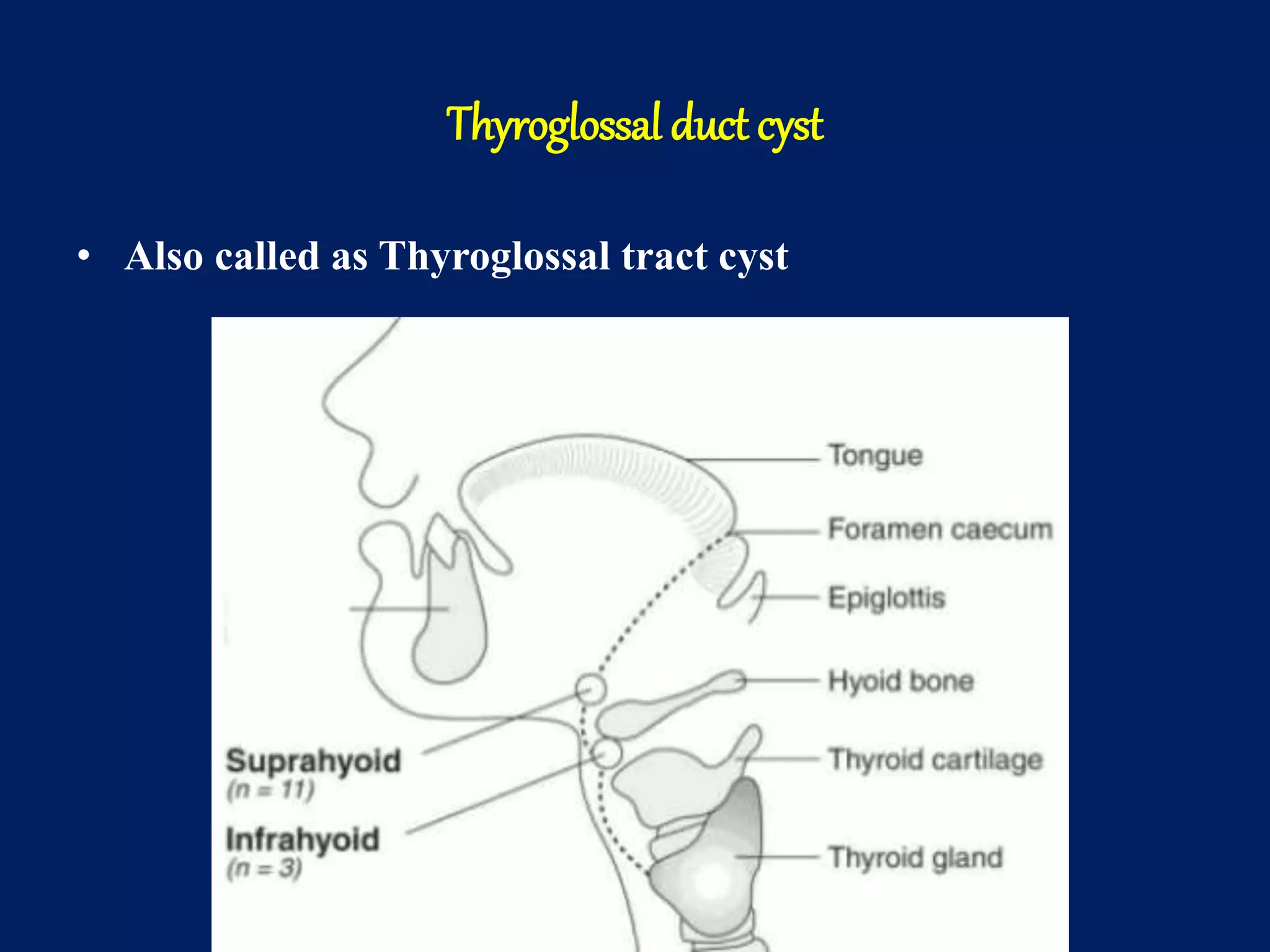 Non odontogenic cysts or fissural cysts | PPTX