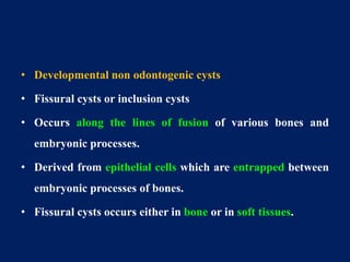 Globulomaxillary Cyst Ppt