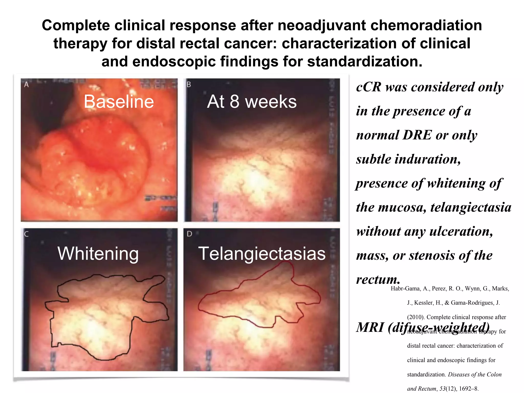 Watch & Wait' in rectal cancer | PPTX