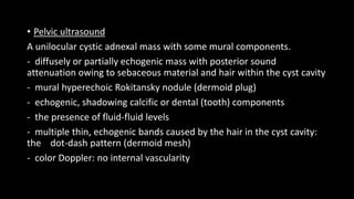 Imaging (CT MRI) of non ovarian cystic pelvic masses. | PPT