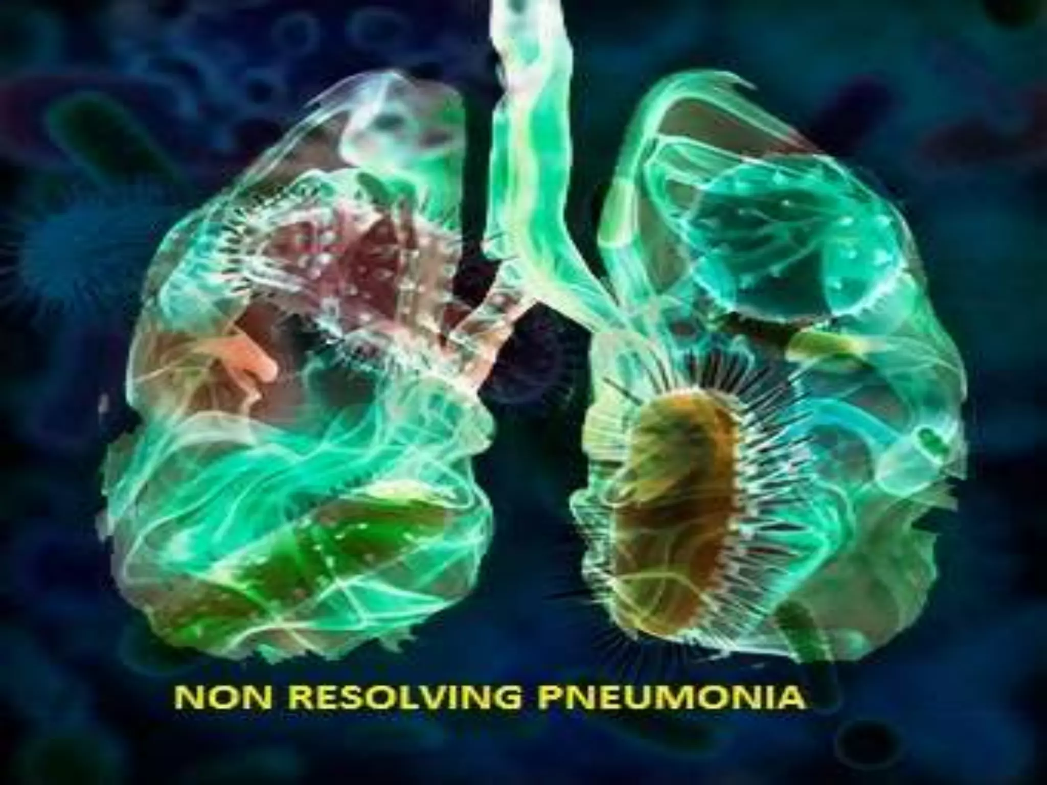 NON RESOLVING PNEUMONIA | PPTX