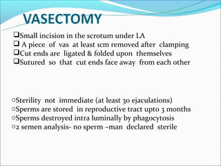 No- scalpel vasectomy | PPT