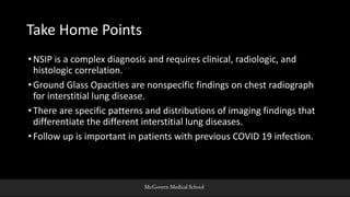 Nonspecific-Interstitial-Pneumonia-NSIP-Interstitial-Lung-Disease-ILD_Ashley-Tom-MS4_Su-MD_Awdeh ...