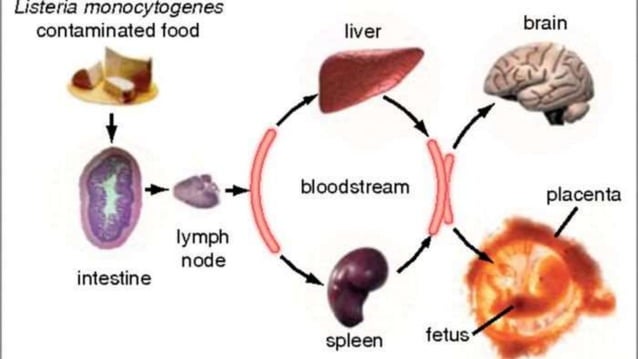 gram positive rods (Non spore forming) | PPTX | Infectious Diseases ...