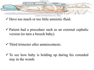Non stress test | PPTX