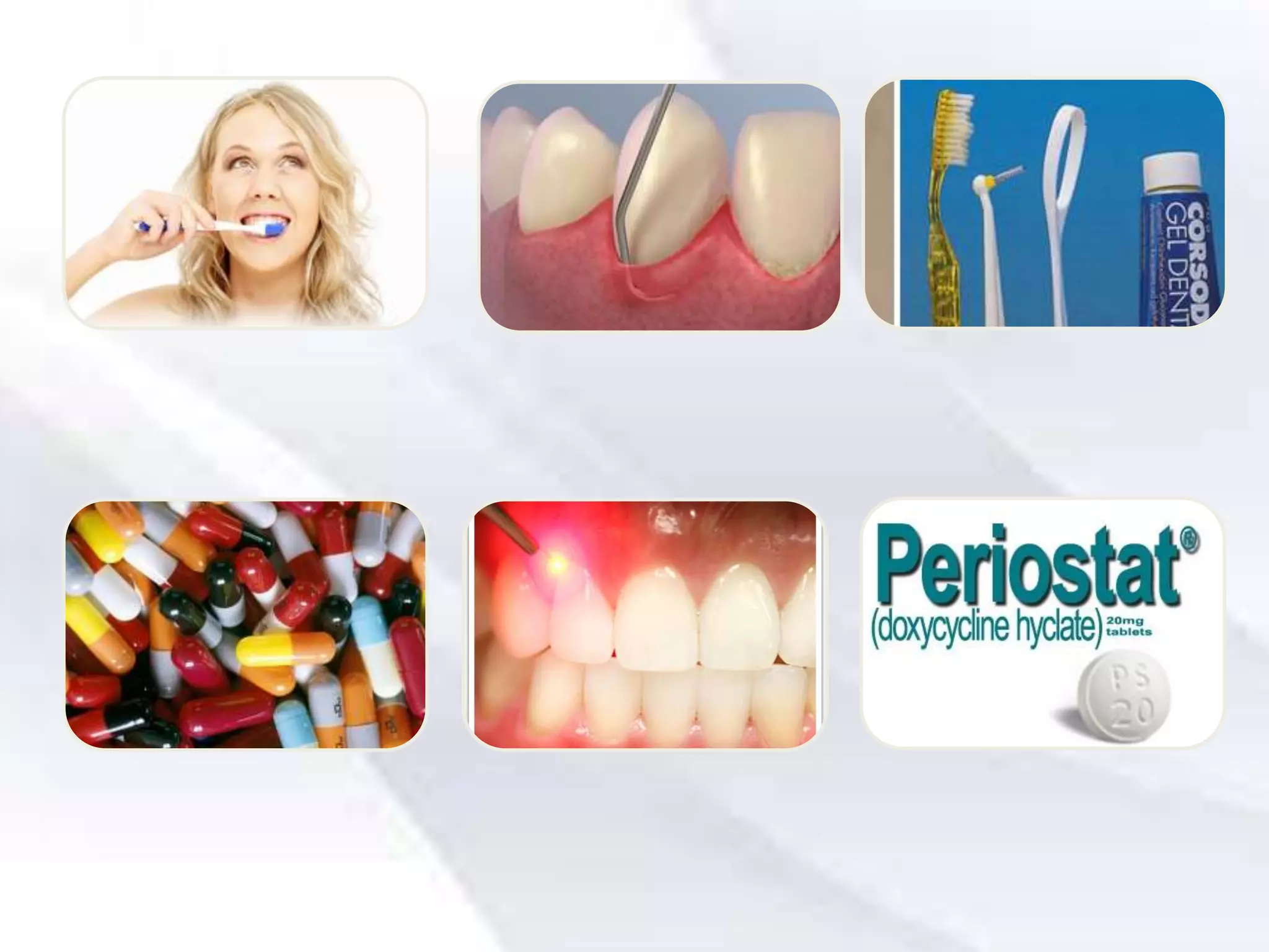 Non surgical in perio | PPTX