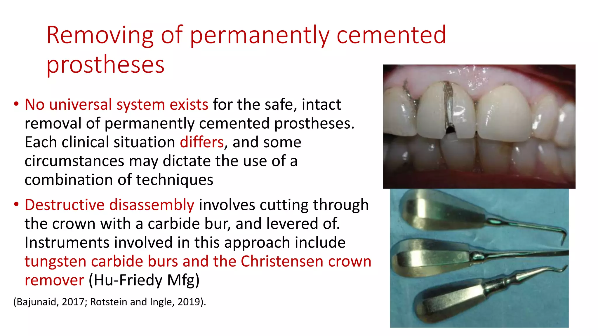 non surgical endodontic retreatment.pptx
