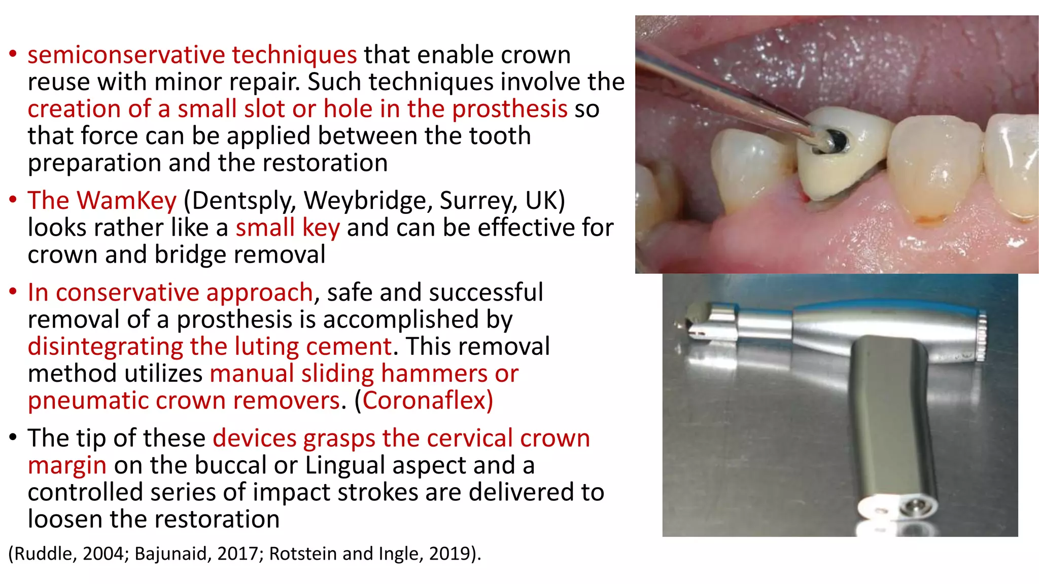 non surgical endodontic retreatment.pptx
