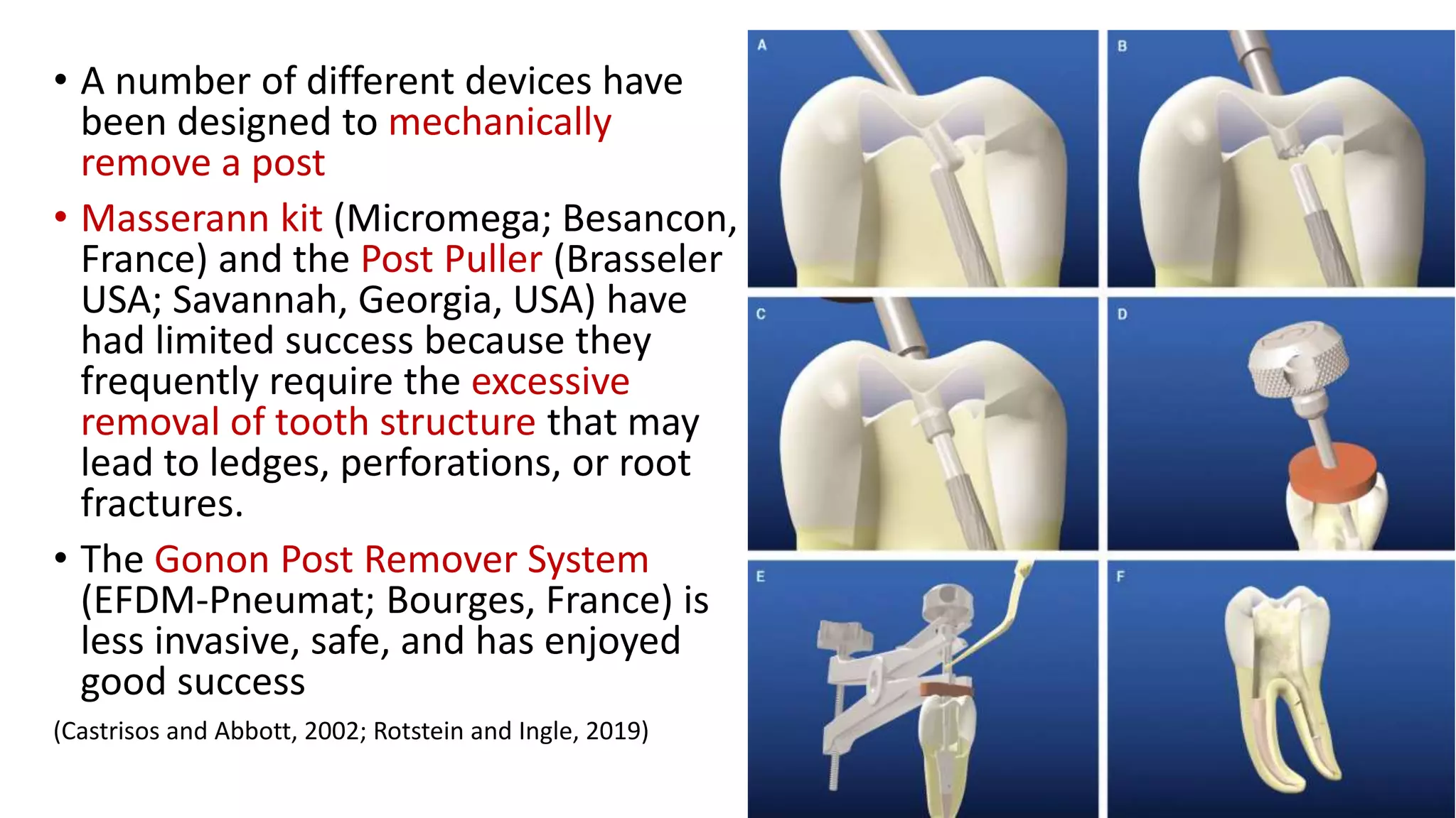 non surgical endodontic retreatment.pptx