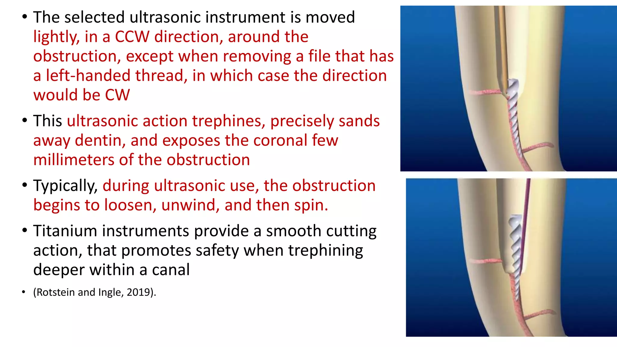 non surgical endodontic retreatment.pptx