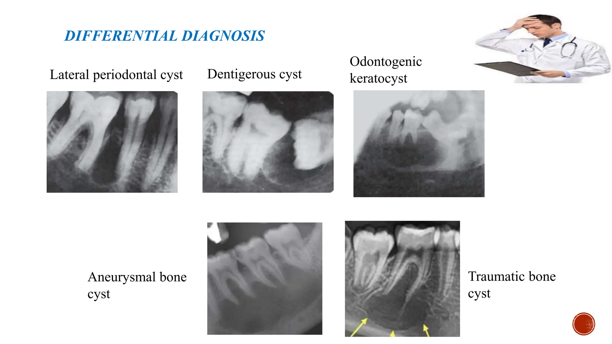 NON SURGICAL MANAGEMENT OF RADICULAR CYST.pptx | Dental Health ...