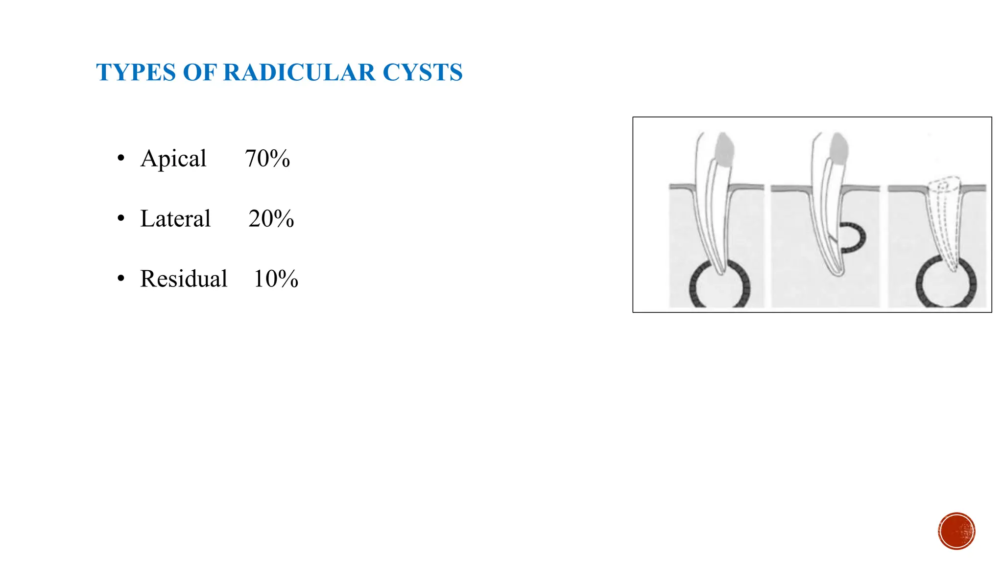 NON SURGICAL MANAGEMENT OF RADICULAR CYST.pptx | Dental Health ...