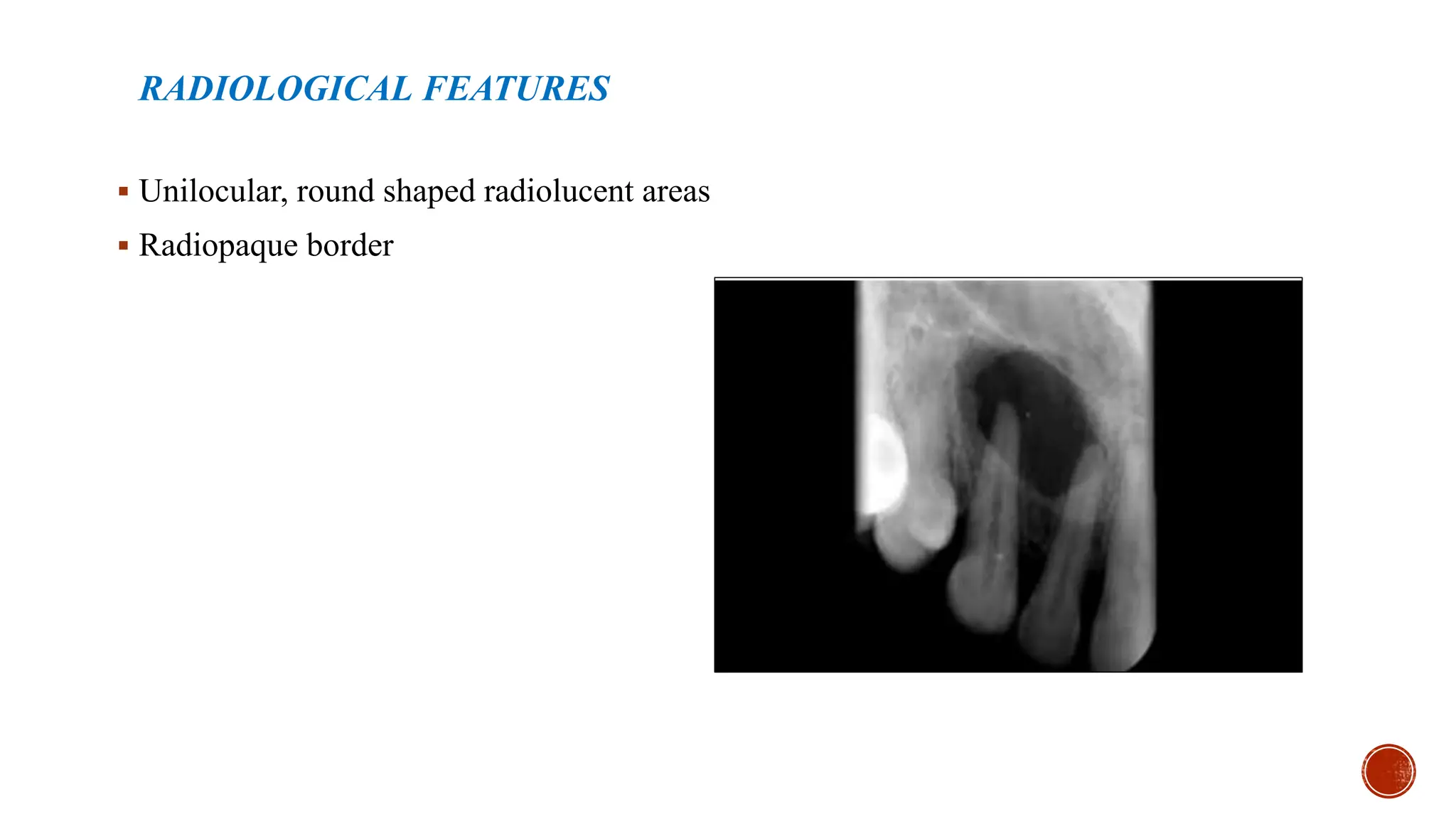 NON SURGICAL MANAGEMENT OF RADICULAR CYST.pptx | Dental Health ...
