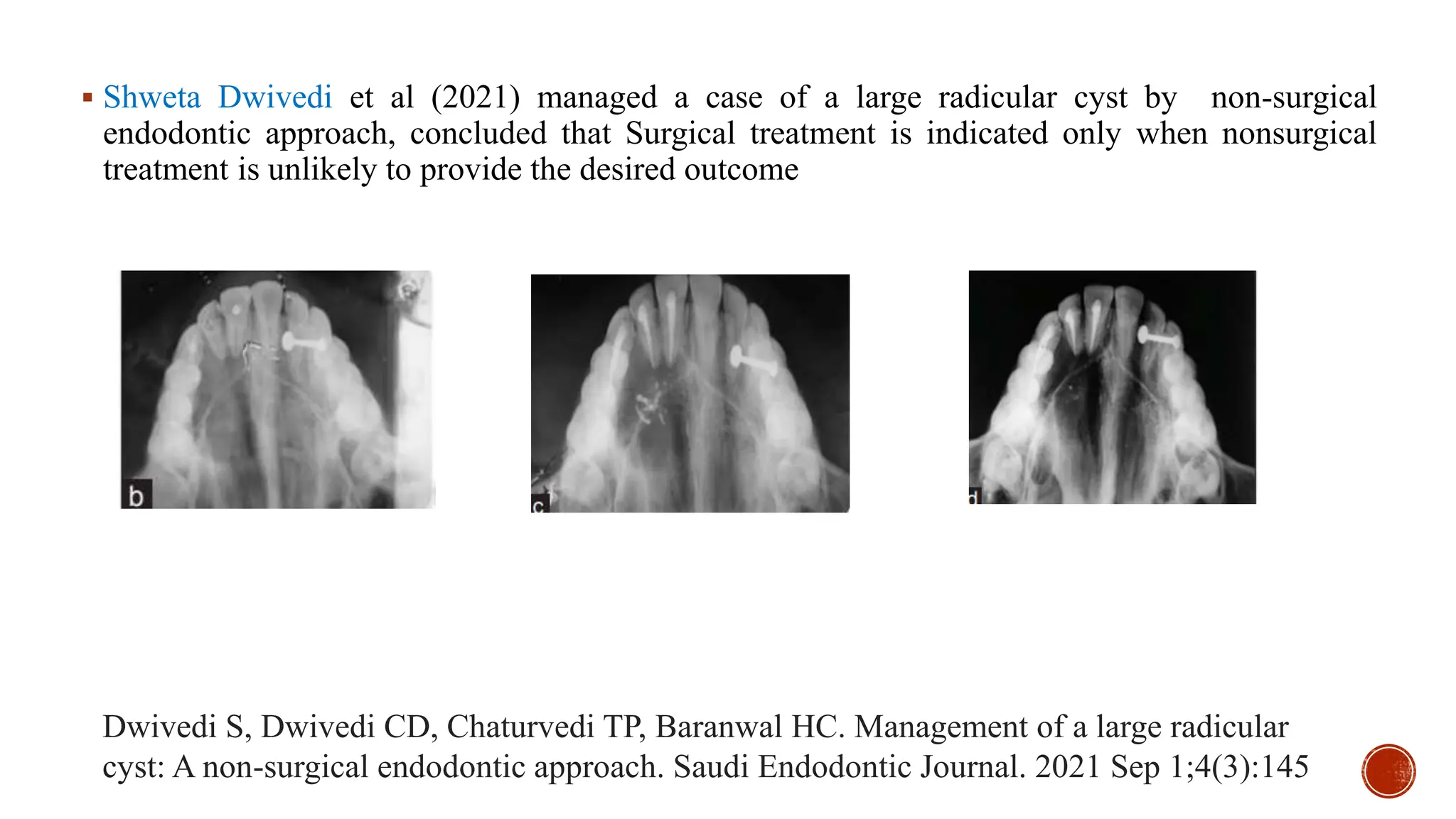 NON SURGICAL MANAGEMENT OF RADICULAR CYST.pptx | Dental Health ...