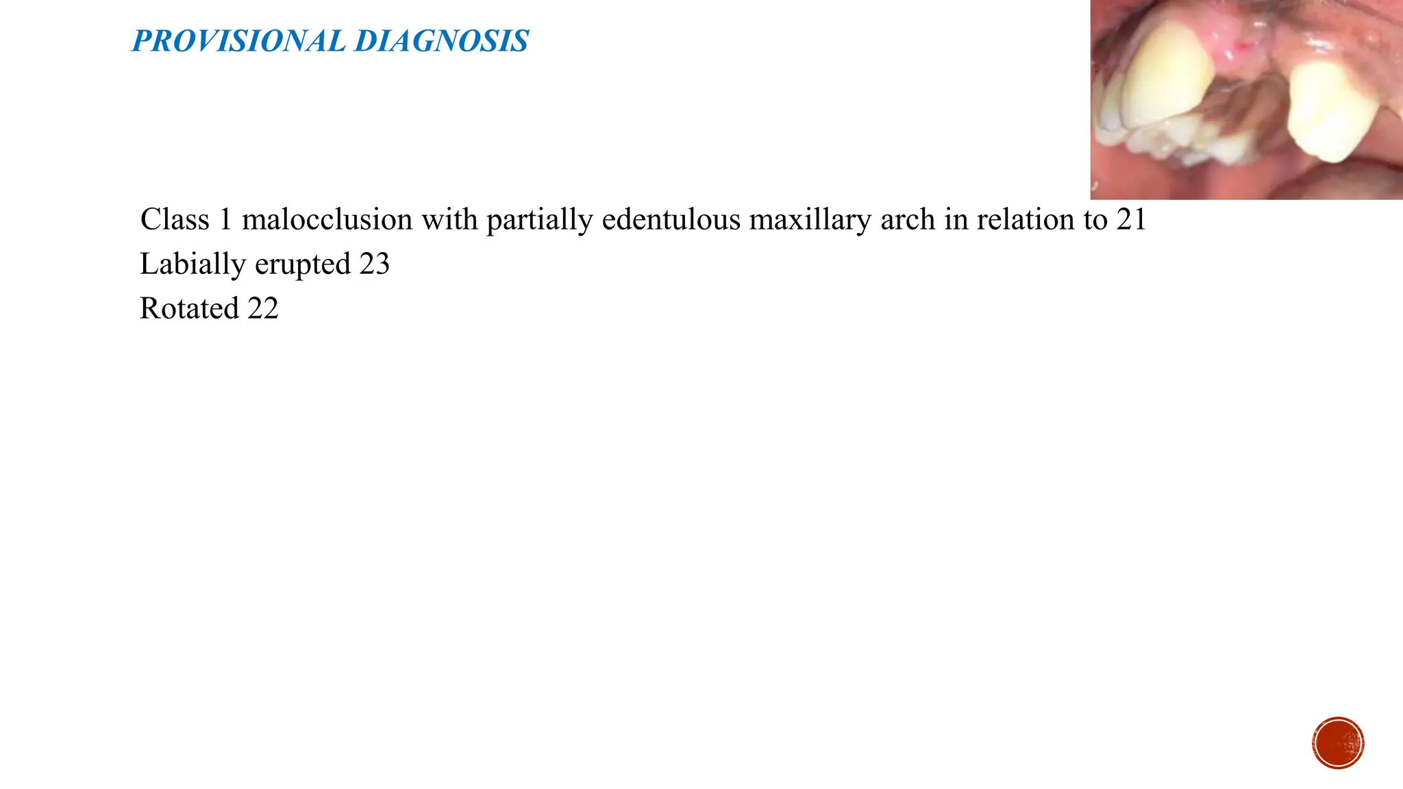 NON SURGICAL MANAGEMENT OF RADICULAR CYST.pptx | Dental Health ...