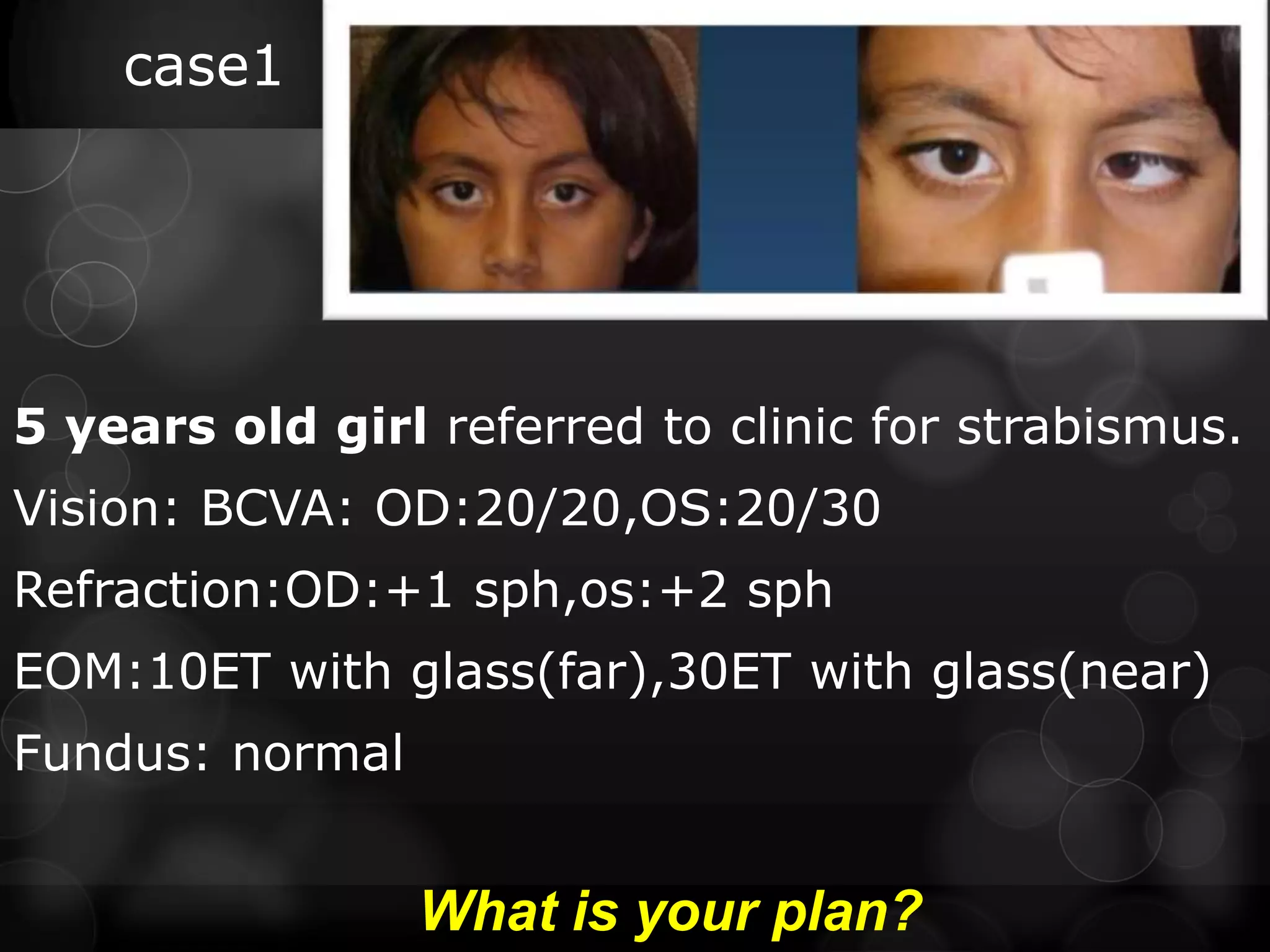 Non surgical management of strabismus .ppt