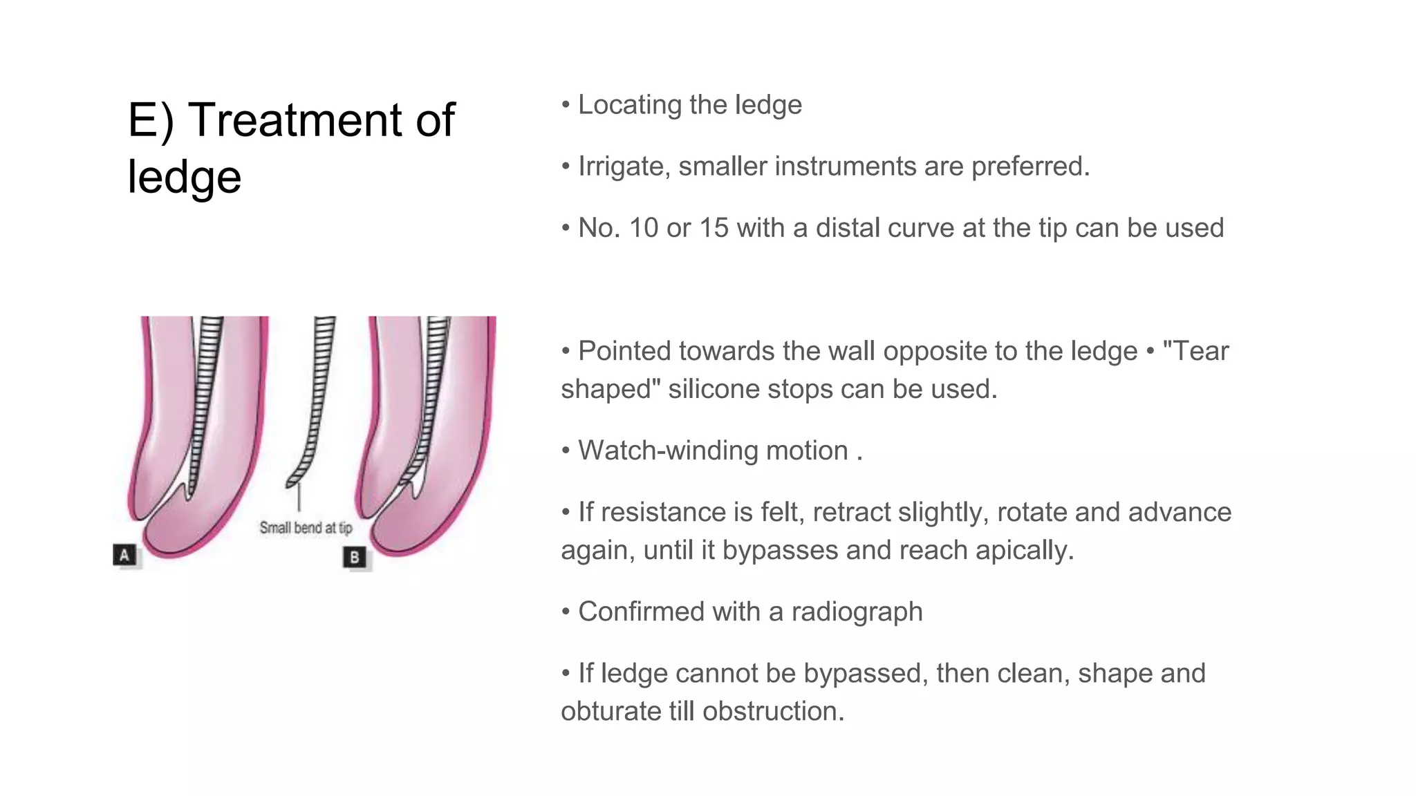 Nonsurgical retreatment in endodontics by Dr. Khirabdhi T Mishra | PPTX