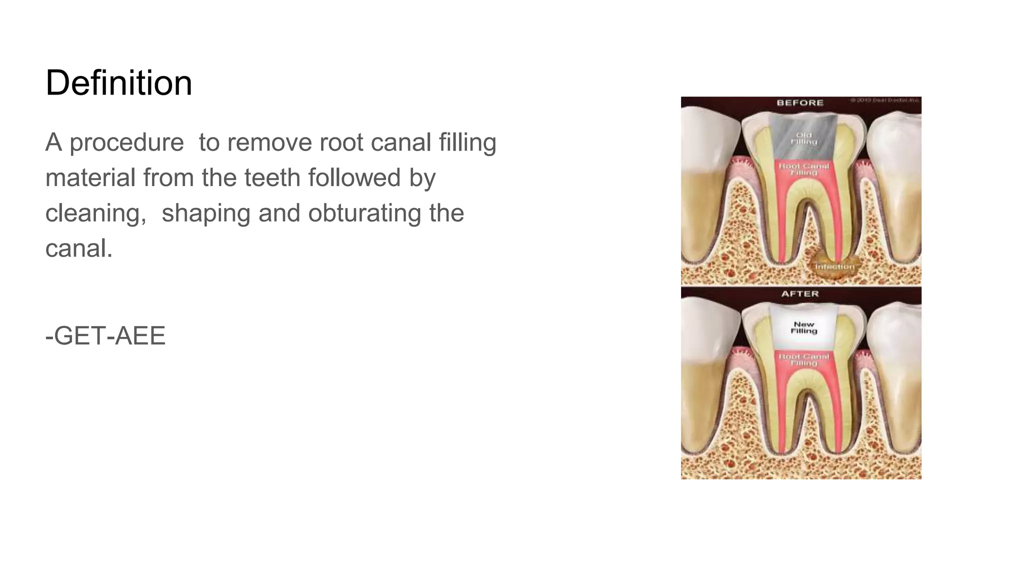 Nonsurgical retreatment in endodontics by Dr. Khirabdhi T Mishra | PPTX