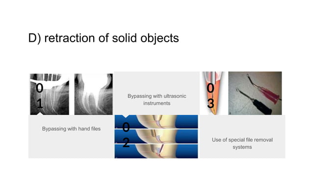 Nonsurgical retreatment in endodontics by Dr. Khirabdhi T Mishra | PPTX