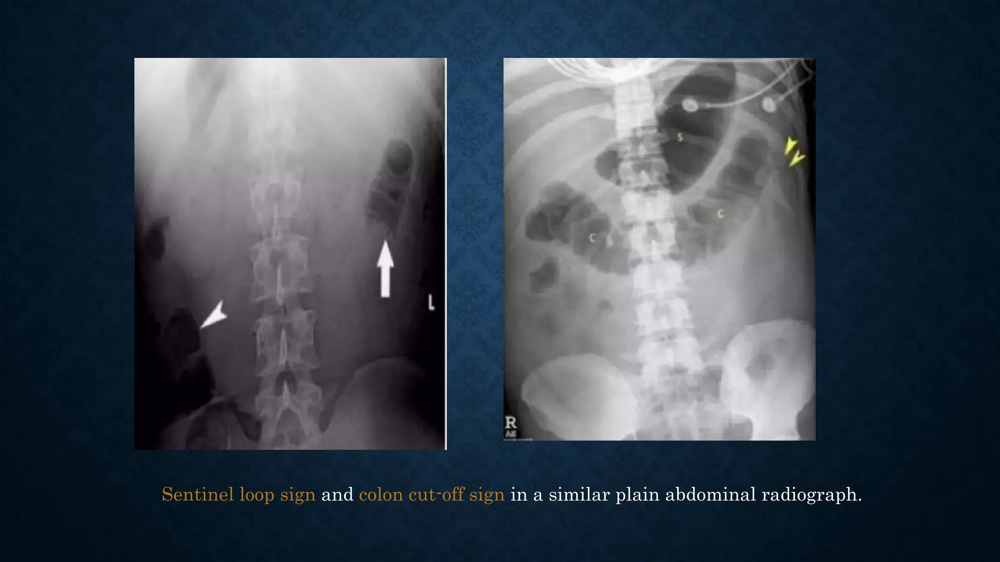 Non traumatic acute abdominal conditions .pptx