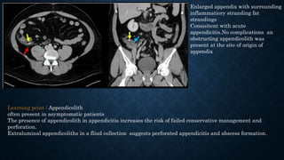 Non traumatic acute abdominal conditions .pptx