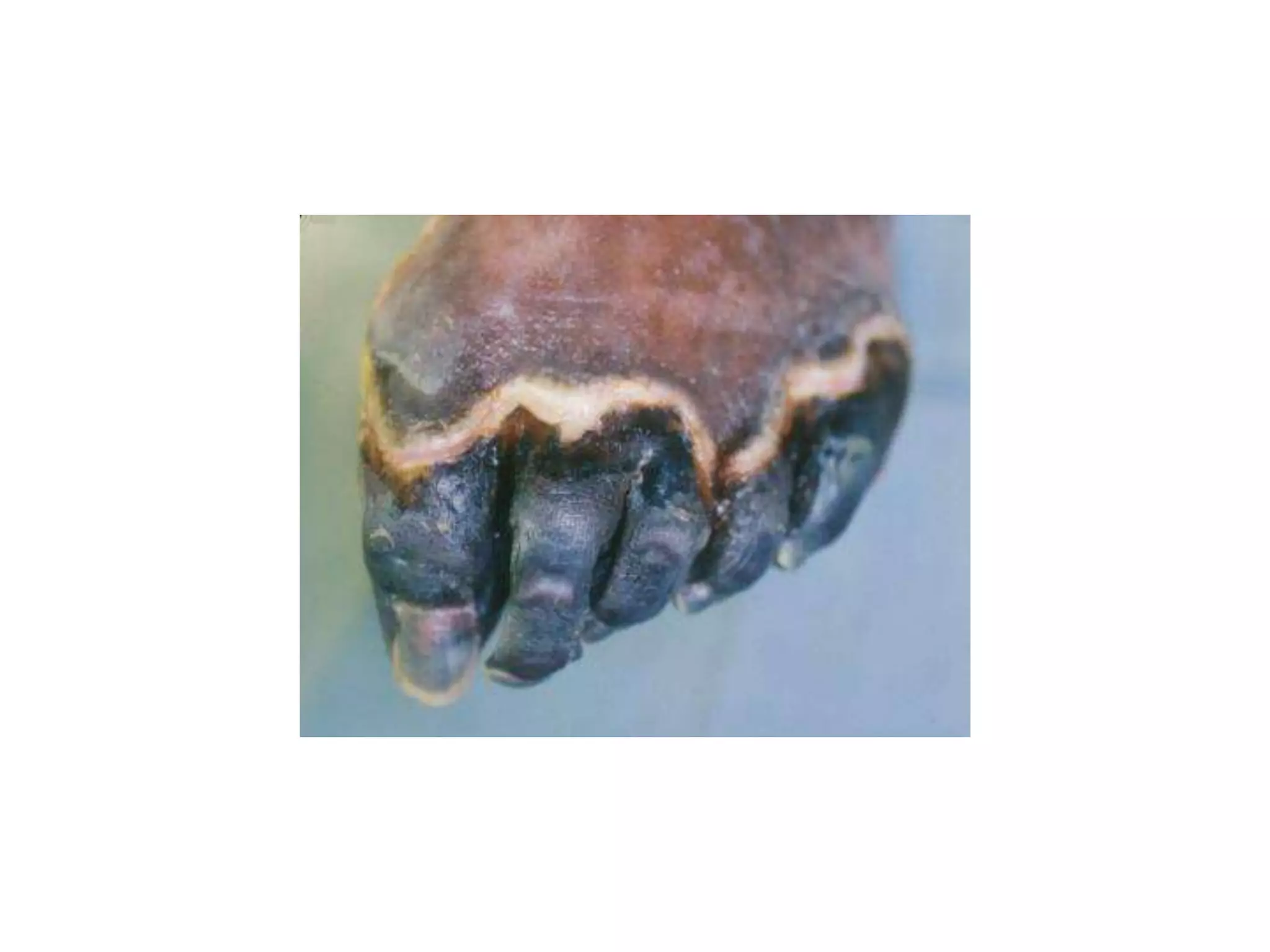 Nontraumatic musculoskeletal disorders | PPTX