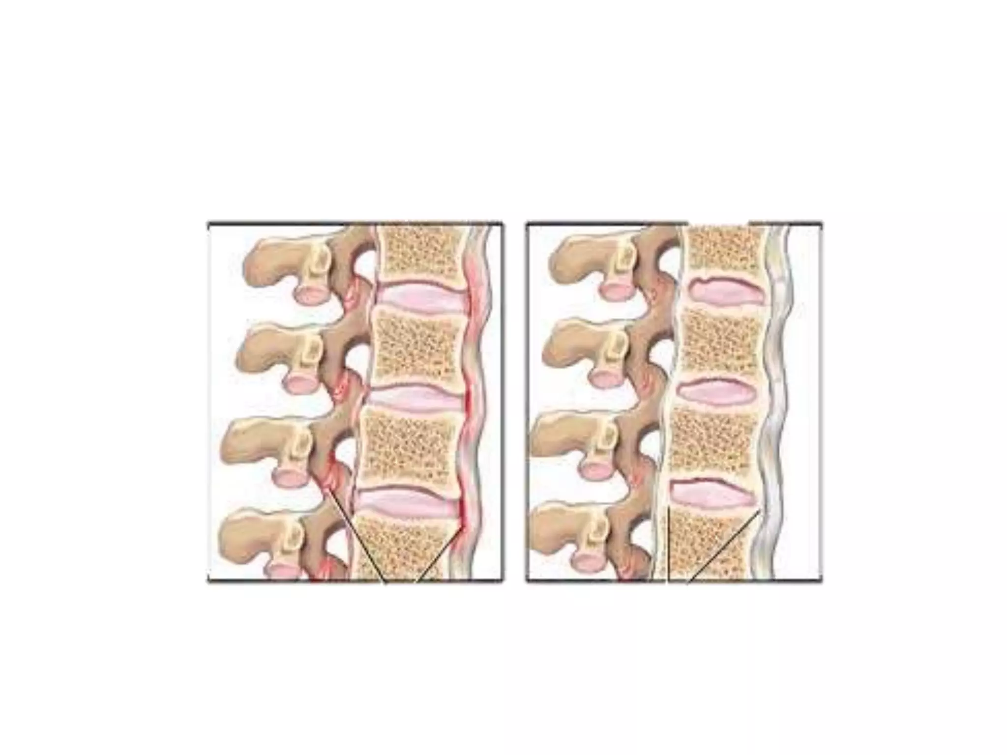 Nontraumatic musculoskeletal disorders | PPTX