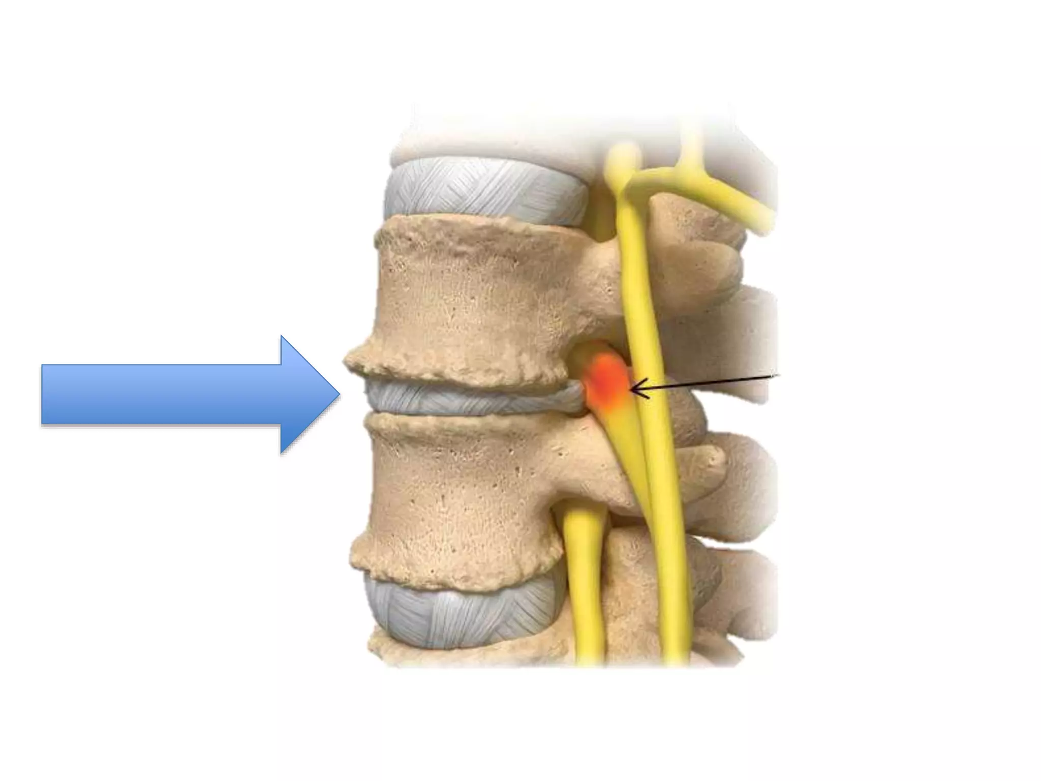 Nontraumatic musculoskeletal disorders | PPTX