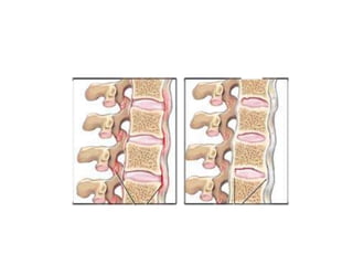 Nontraumatic musculoskeletal disorders | PPTX