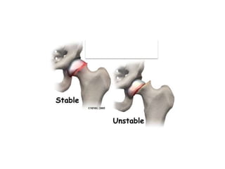 Nontraumatic musculoskeletal disorders | PPT