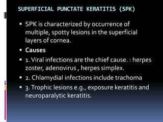 Superficial Punctate Keratitis Spk