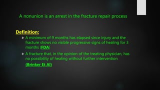 NONUNION.pptx