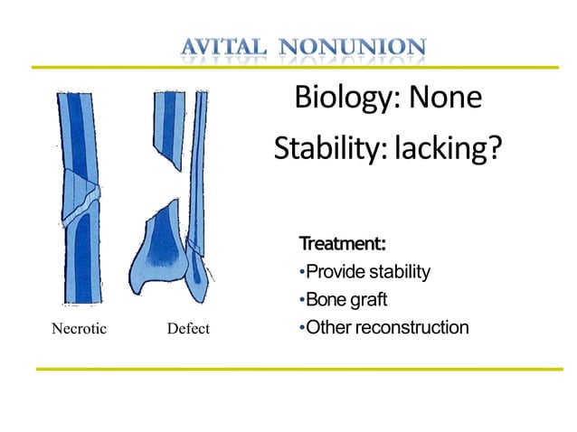 NON UNION AND CHRONIC OSTEOMYELITIS | PPT