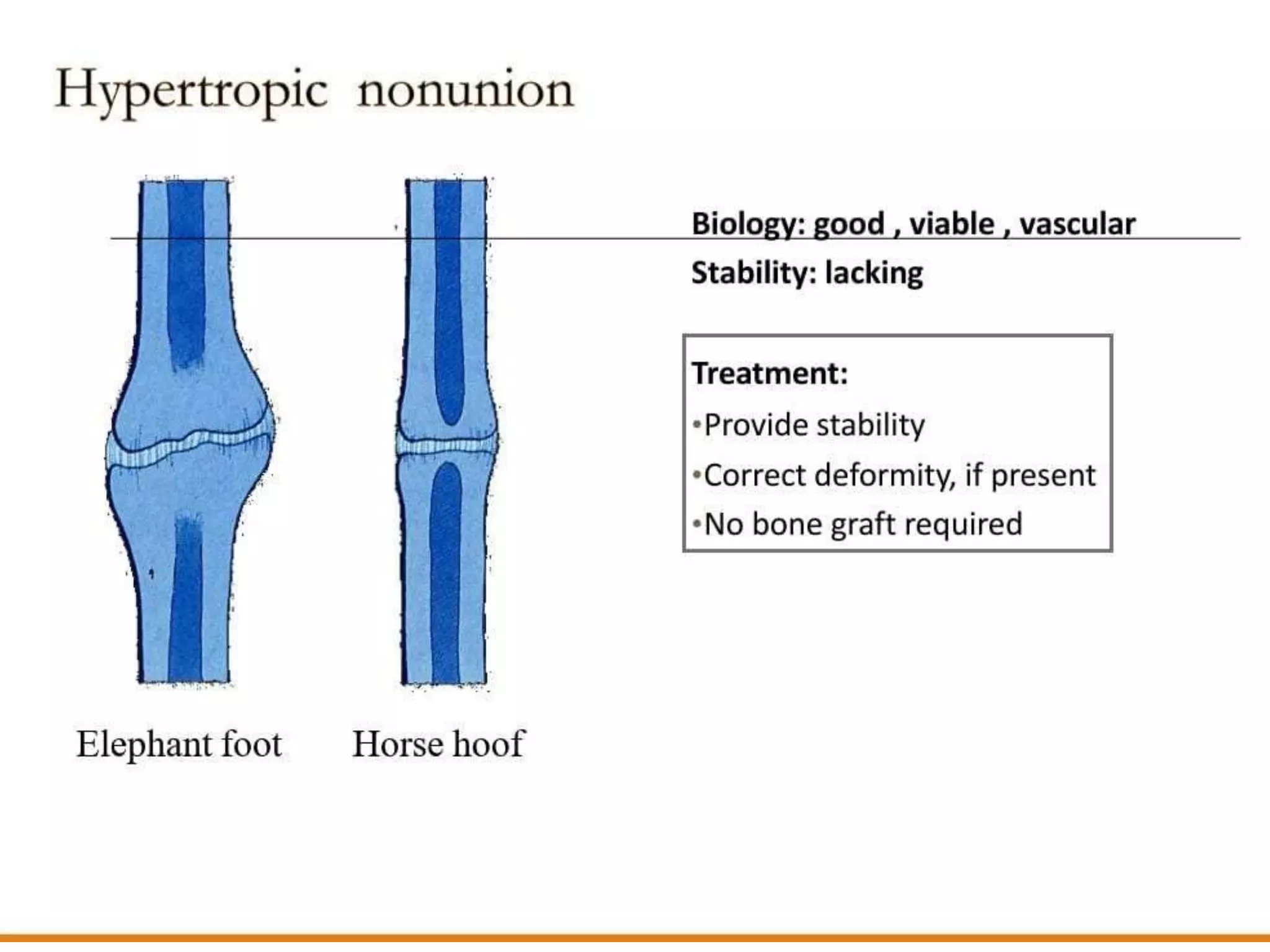 non union and malunion final.pptx