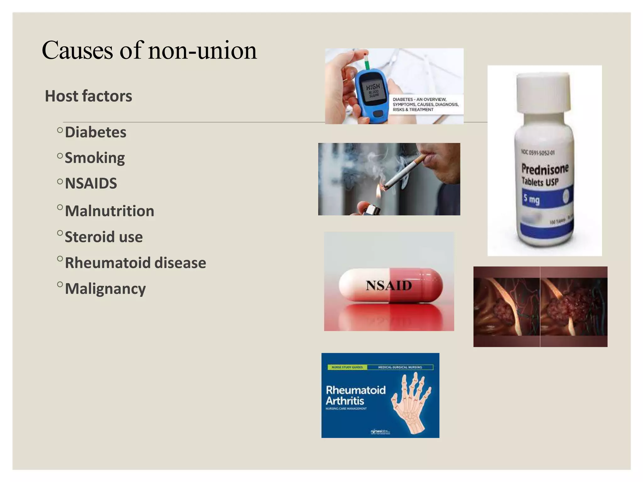 non union and malunion final.pptx