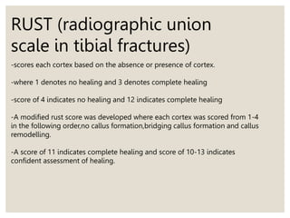non union and malunion final.pptx