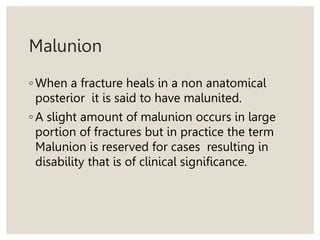 non union and malunion final.pptx