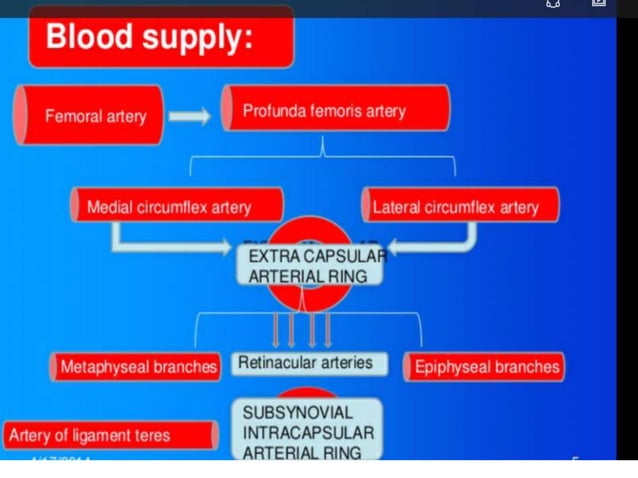 Nonunion femoral neck fractures | PPTX | Death, Injury, or Military ...