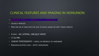 non union of bones.pptx