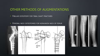 non union of bones.pptx