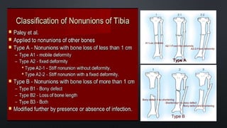 non union of bones.pptx