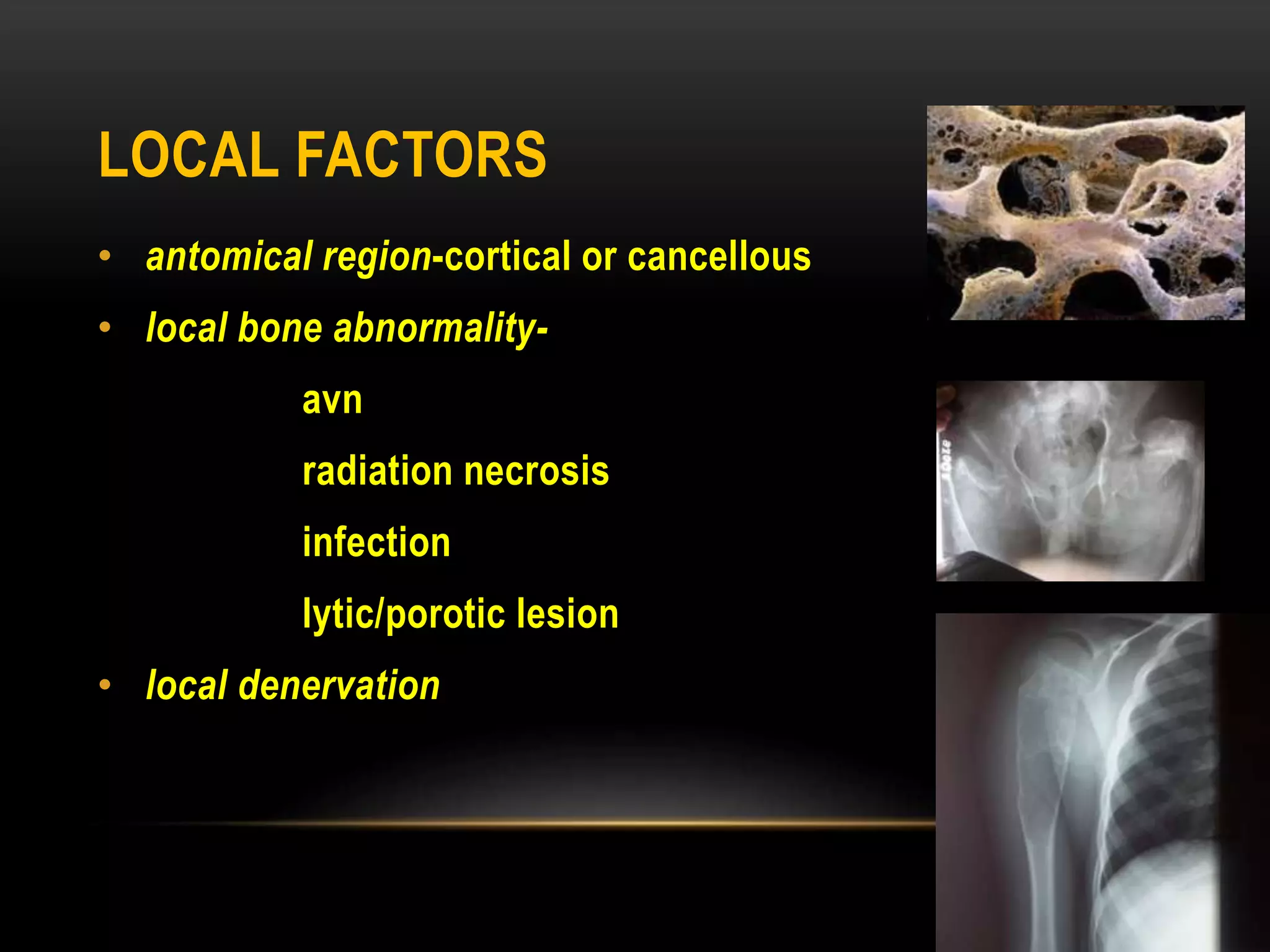Non union of fractures dr mohamed ashraf,HOD orthopaedics,govt TD ...