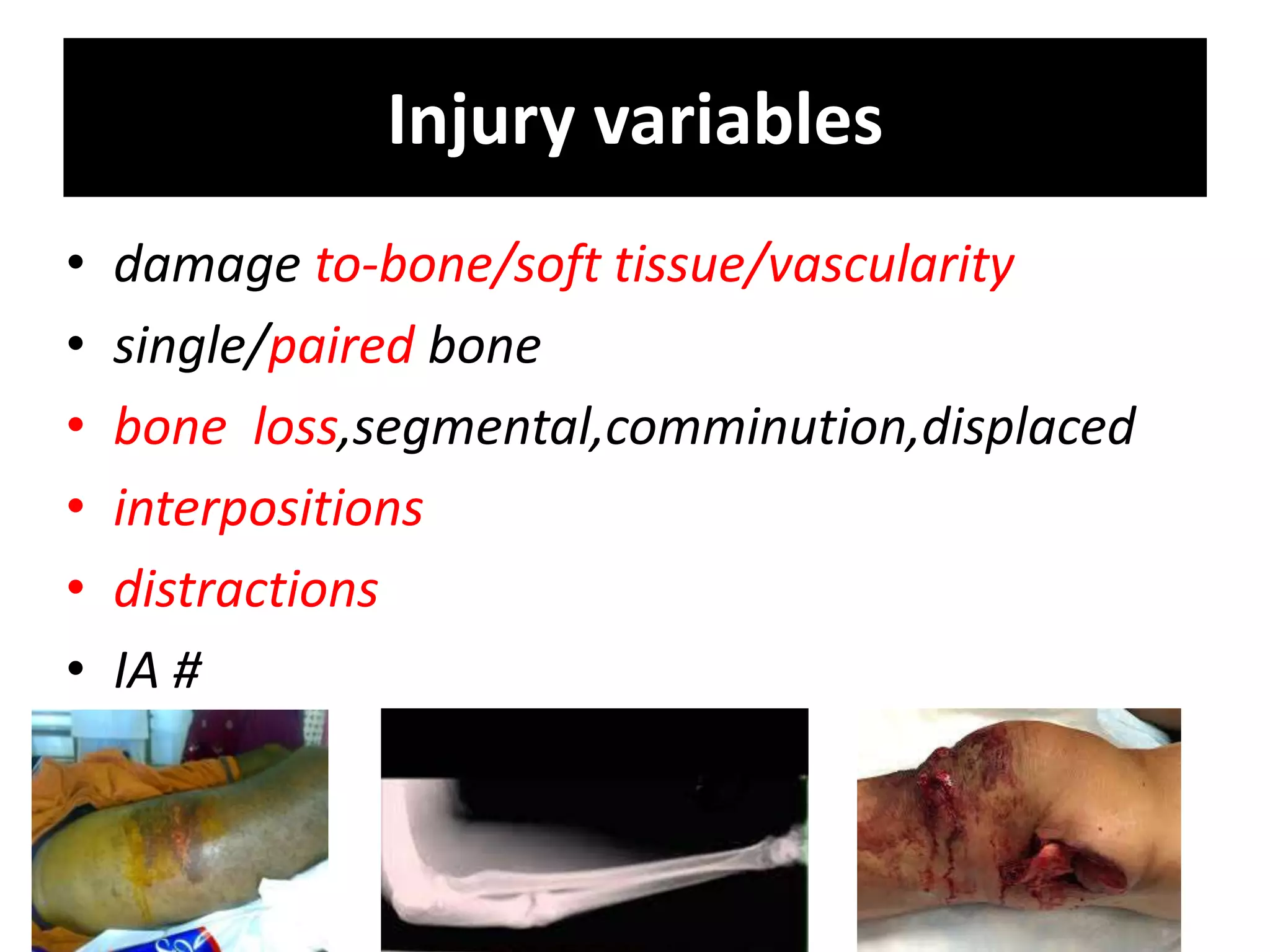 Non union of fractures dr mohamed ashraf,HOD orthopaedics,govt TD ...