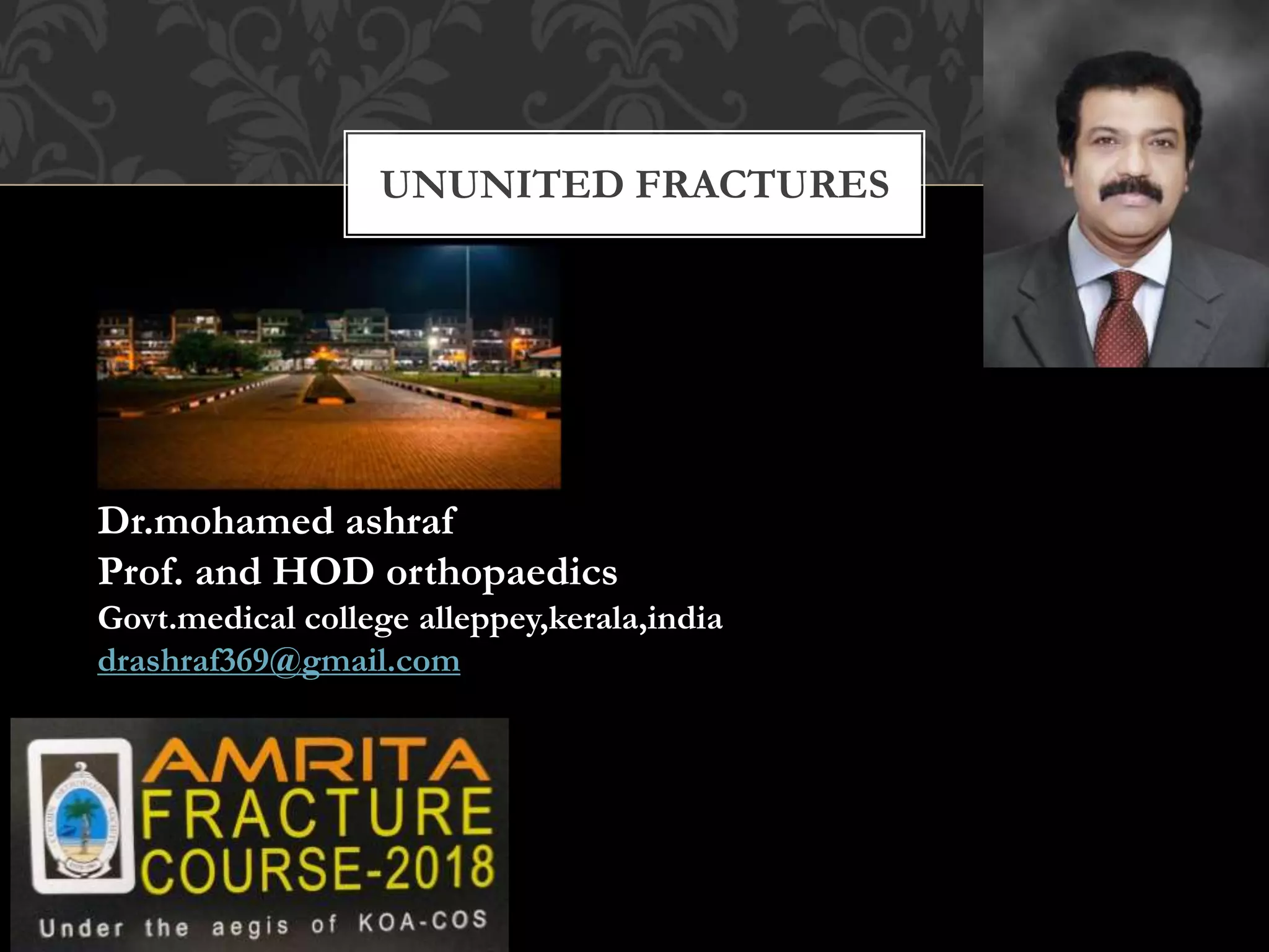 Non union of fractures dr mohamed ashraf,HOD orthopaedics,govt TD ...