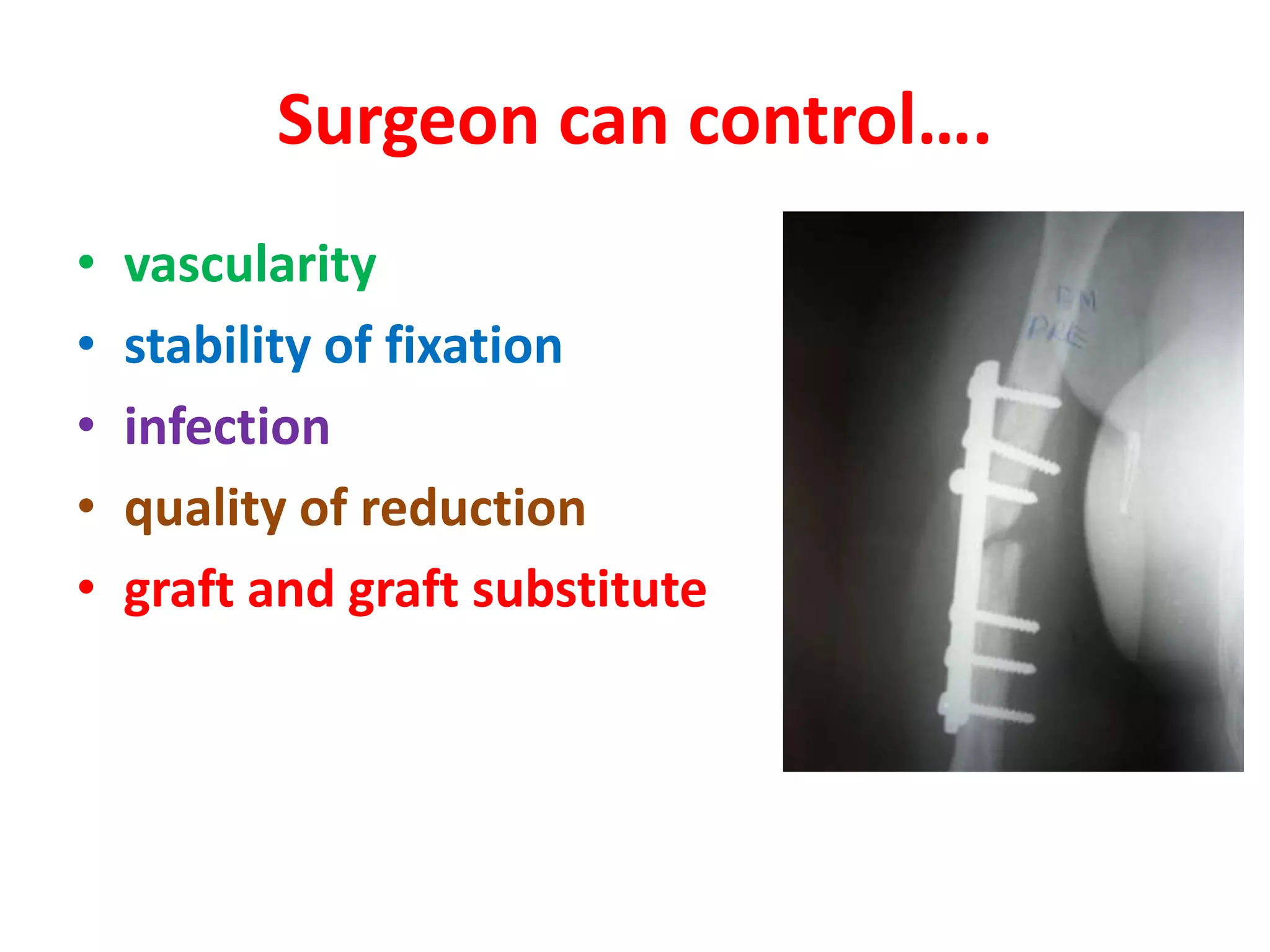 Non union of fractures dr mohamed ashraf,HOD orthopaedics,govt TD ...