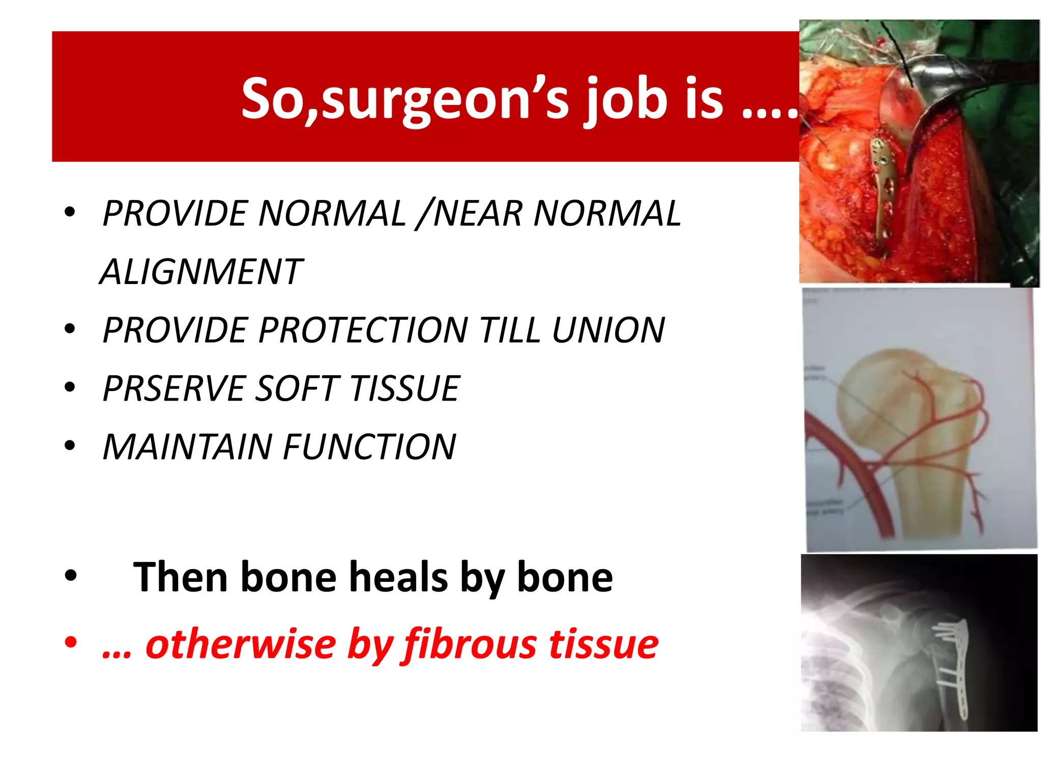 Non union of fractures dr mohamed ashraf,HOD orthopaedics,govt TD ...